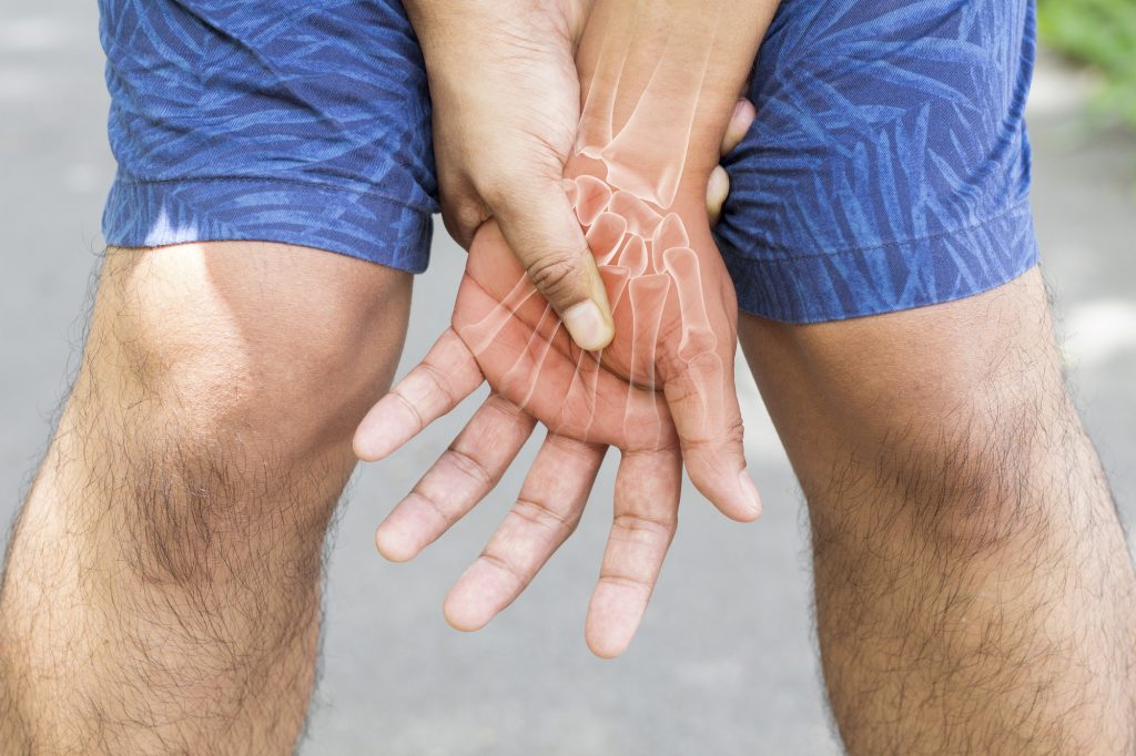 Comment traiter des blessures sportives courantes aux mains ? - Le Guide